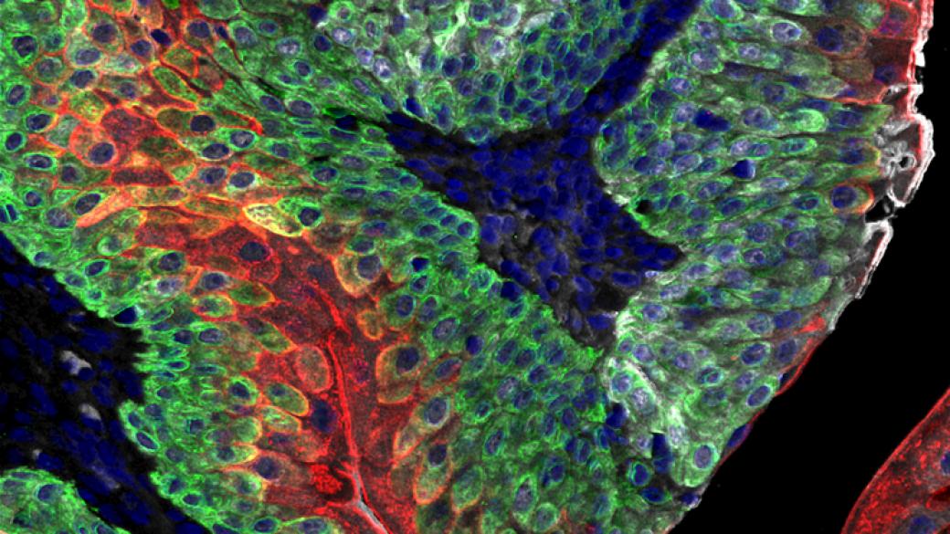 Abate-Shen Lab | Department of Molecular Pharmacology and Therapeutics Abate-Shen Lab | Department of Molecular Pharmacology and Therapeutics