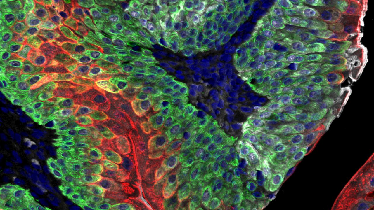 Research | Department of Molecular Pharmacology and Therapeutics